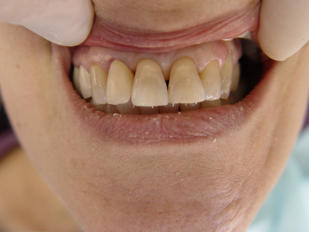 Smile Gallery Archive - Payam Cohen