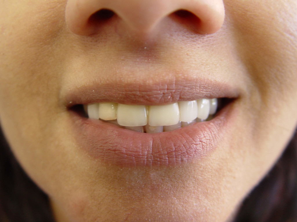 Smile Gallery Archive - Payam Cohen